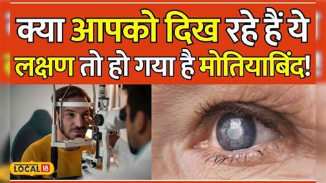 Cataract Prevention आंखों में दिख रहे हैं ये लक्षण तो समझ जाइए हो गया