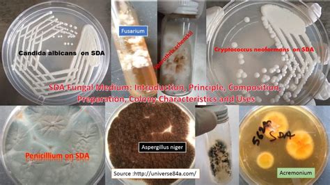 Cryptococcus Colony On Sda