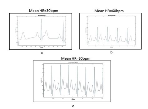 The Ecg Model To Generate The A Mean Hr 30bpm B Mean Hr 60bpm And Download Scientific