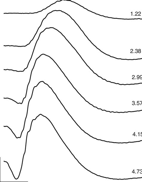Electroretinogram Erg Responses To A Series Of Fl Ashes Of Increasing