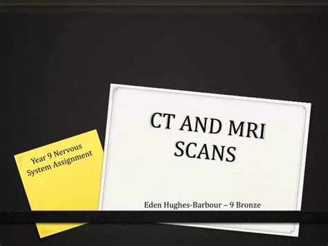 PPT CT AND MRI SCANS PowerPoint Presentation Free Download ID 2865314