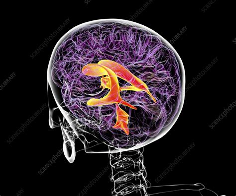 Ventricular System Of The Brain Illustration Stock Image F040 4176