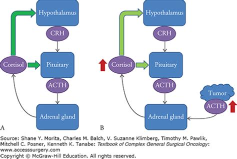Ectopic Acth Syndrome Oncohema Key