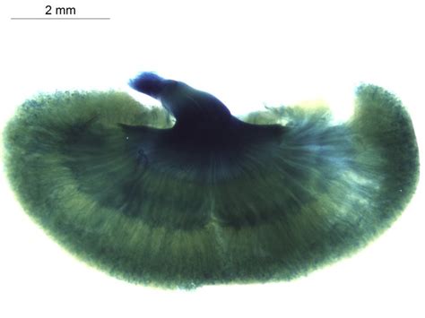 Nup62 Mgi Mouse Gene Detail Mgi1351500 Nucleoporin 62