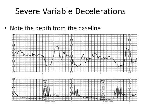 Mbbs Medicine Humanity First Assessment Of Fetal Well Being