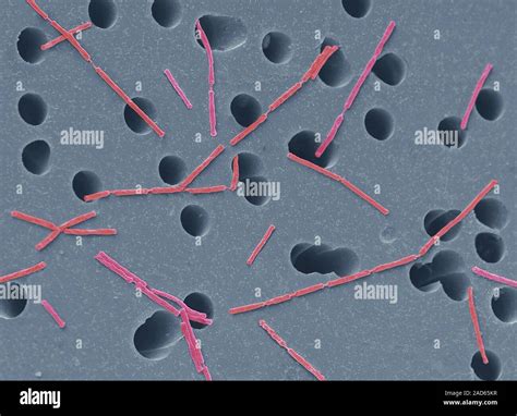 Coloured Scanning Electron Micrograph Sem Of An Archaea Extremophile