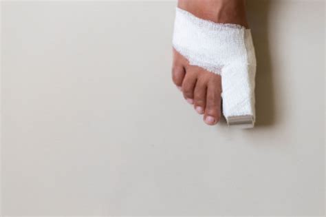 Exploring Varieties Of Foot And Toe Fractures