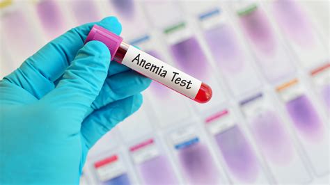 Anemia Hub — Diverse Health Hub