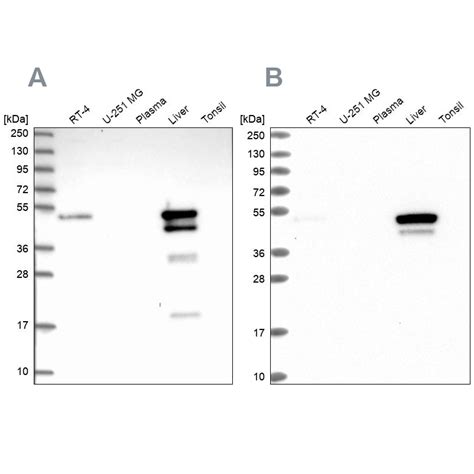 Rabbit Polyclonal Anti Abat Antibody Buy For Research Highly