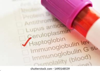 Haptoglobin Images Stock Photos Vectors Shutterstock
