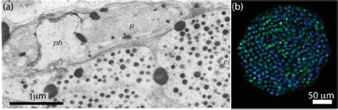 Structural Color From Iridescent Bodies A Tem Micrographs Of