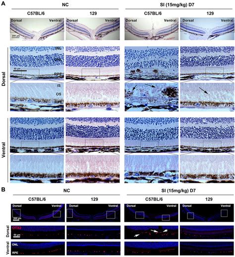 Rpe Degeneration In The Dorsal Region Is Prevented In 129 Mice Treated