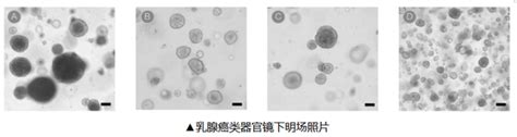百奥创新：乳腺癌3d类器官培养基介绍 知乎