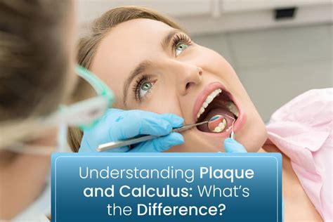 Understanding Plaque And Calculus Whats The Difference Dr Monica