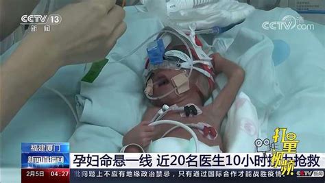 厦门孕妇突发主动脉夹层命悬一线近20名医生10小时接力抢救 社会 民生 好看视频