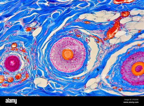 Human Scalp Cross Section Showing Hair Follicles And Fibrous Tissue Optical Microscope X200