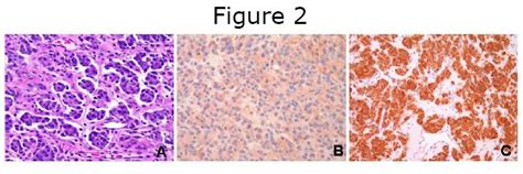 Researcher Update In Pediatric Gist The Life Raft Group