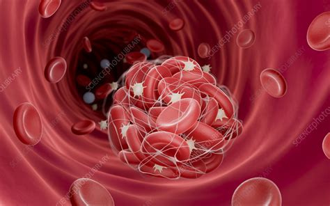 Blood Clot Illustration Stock Image F0377088 Science Photo Library