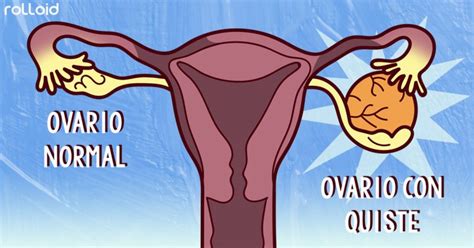 8 Cosas que deberíamos hacer durante 5 semanas para combatir los