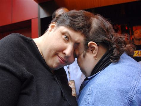 Lori Y George Schappell Los Siameses Más Longevos Del Mundo Mueren A