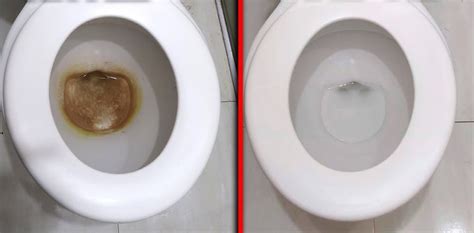 Cómo quitar las manchas de cal de la taza del inodoro y dejarla como