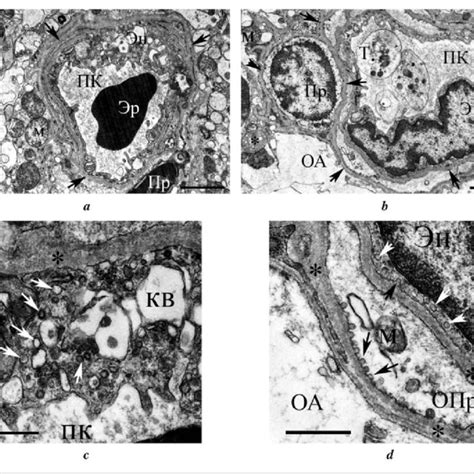 Schematic Representation Of How Electrostatic Repulsive Interactions