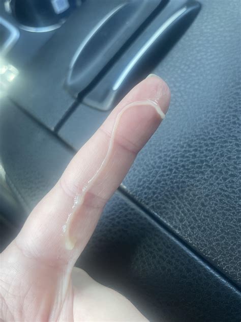 String Like Mucus Rallergy