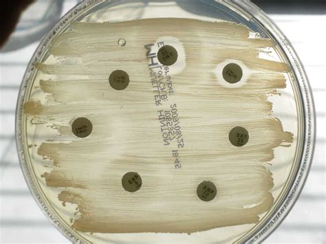 Antibiogramm Wikiwand