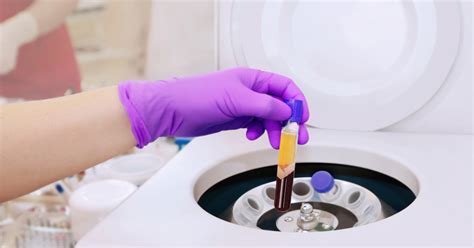 Centrifuge Top Tips Part 1 Types Of Centrifuges And Rotors Richmond