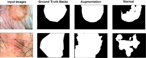 Segmentation Obtained From Mobilenetv Unet Model Training From Left
