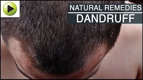 Hair Care Dandruff Natural Ayurvedic Home Remedies Youtube