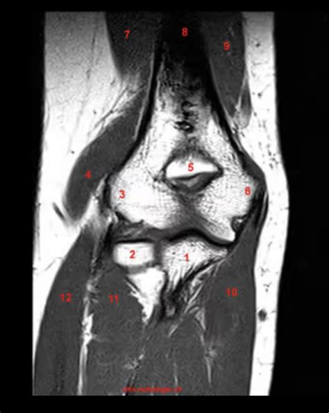 Diagram Of Elbow Mri 6 Quizlet