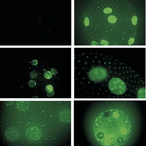 Fluorescence Microscopy Visualization Of Ros During The Sex Inducing