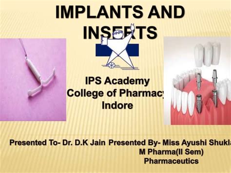 Implants And Inserts Ppt Pptx