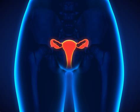 Endometriose A Principal Causa Da Infertilidade Feminina