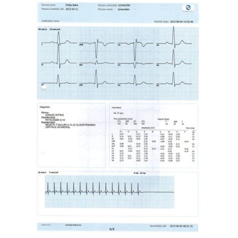 Innobase Ecg Software For Windows Winterthur Medical Plc
