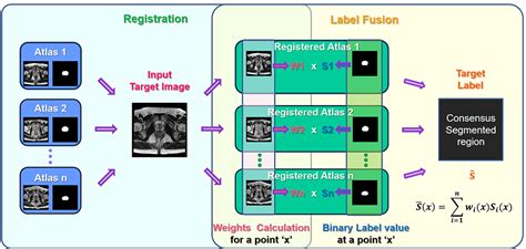 Optimization Of Multi Atlas Segmentation With Joint Label Fusion Algorithm For Automatic