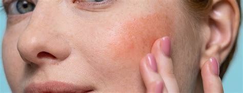 Comment avoir un beau teint l hiver Eugénie de Jaham Maquillage
