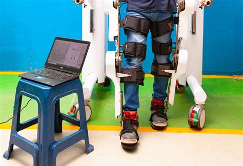 Robotic Exoskeleton Assisted Rehabilitation System Rears Timetooth