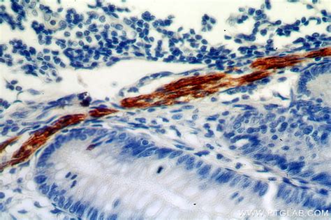 Desmin Antibody 16520 1 Ap Proteintech