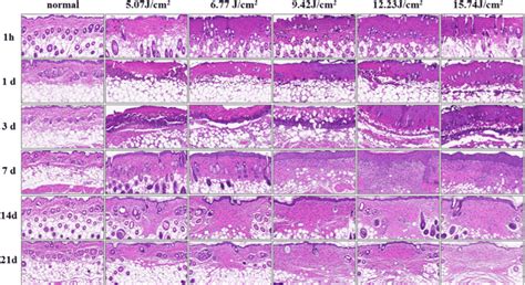 Histological Examination Of Cutaneous Wound Healing In Mice Irradiated