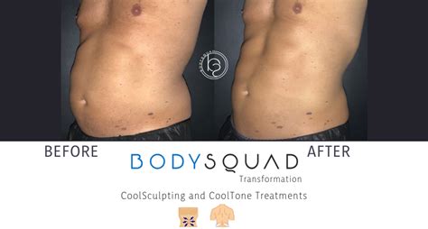 Transformation Of The Week Dad Bod Bodysculpting Transformation The