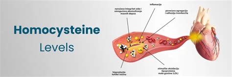 Understanding The Impact Of Homocysteine Levels