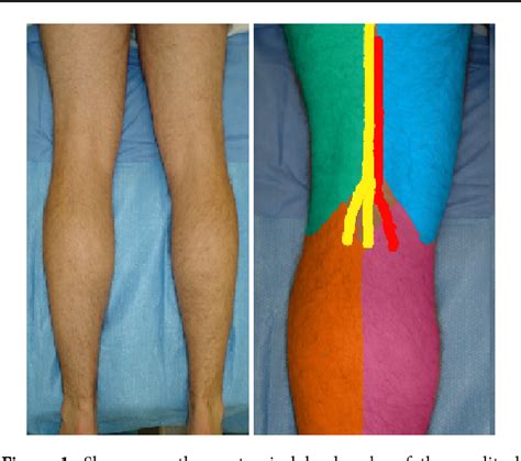 Popliteal Nerve Block Distribution