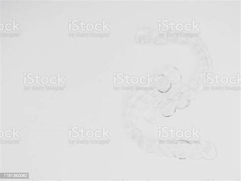 투명 중괄호 또는 정렬기 아름다운 미소와 하얀 이빨을 가질 수있는 방법 건강관리와 의술에 대한 스톡 사진 및 기타 이미지
