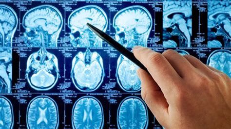 El Cerebro Adicto Cómo Las Drogas Anulan Las Capacidades Humanas Infobae