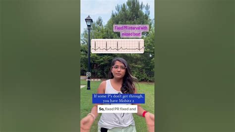 Mobitz Type 2 Youtube
