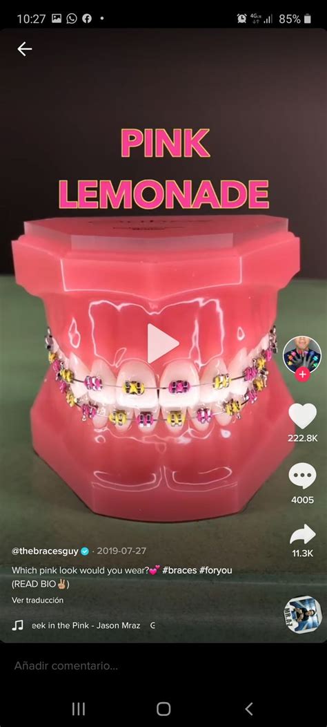 Pin De Darkskinn Queen 😍🤘🏿 En Braces Colors Ligas Para Brackets