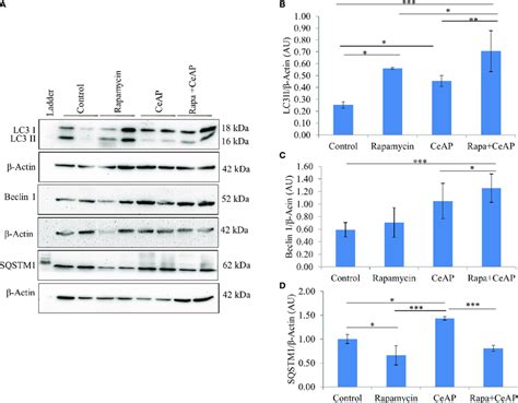 A Immunoblots For The Relative Expression Of Lc3ii Beclin 1 And