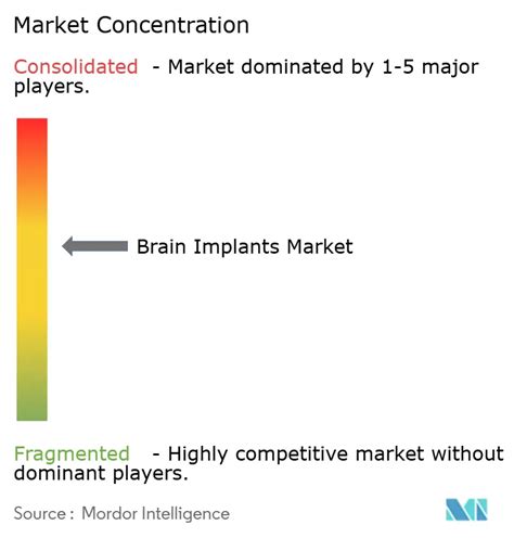 Brain Implants Companies Top Company List